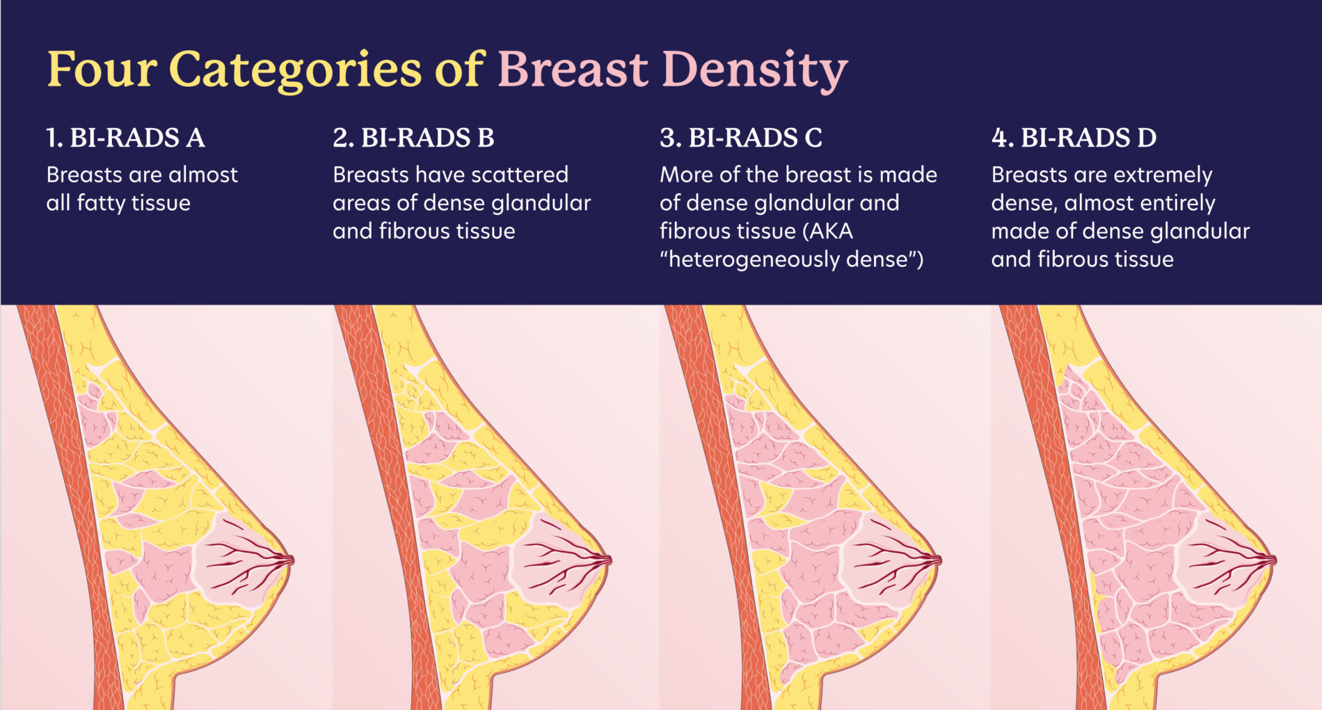 What People with Dense Breasts Should Know About Screening